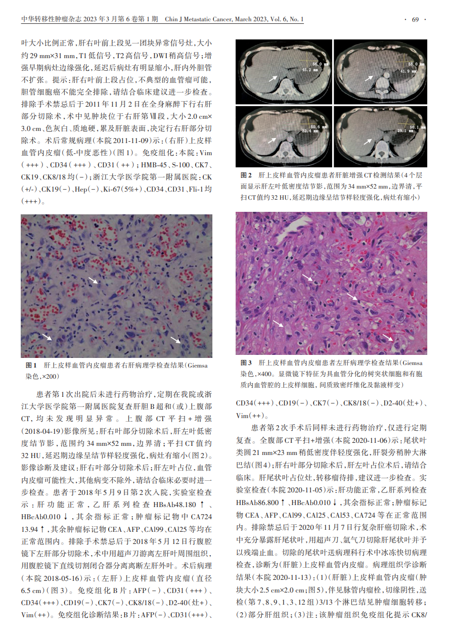 版权说明： 本文首发于《中华转移性肿瘤杂志》2023年第1期，未经授权禁止转载。